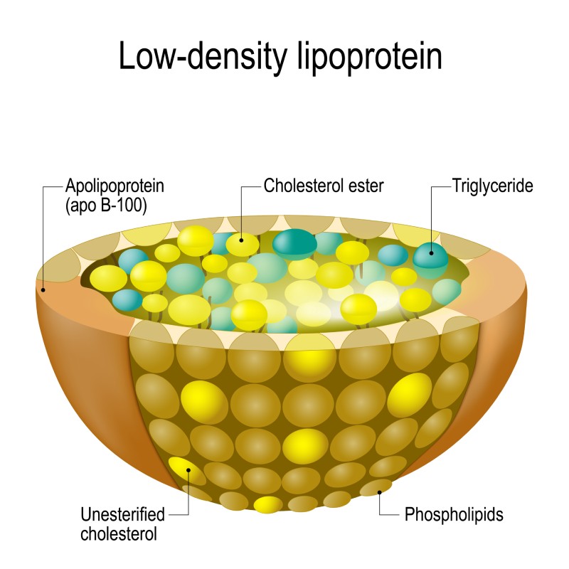 How Cholesterol Is Linked To Heart Disease | Dr. Raghu